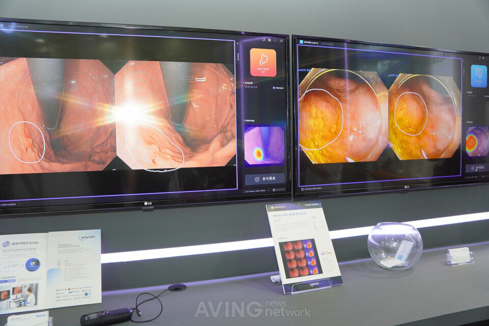 웨이센, KIMES 2023서 CES 혁신상 선정된 AI 기반 의료·헬스케어 솔루션 알려... “90%대 진단 정확도 갖춰!”