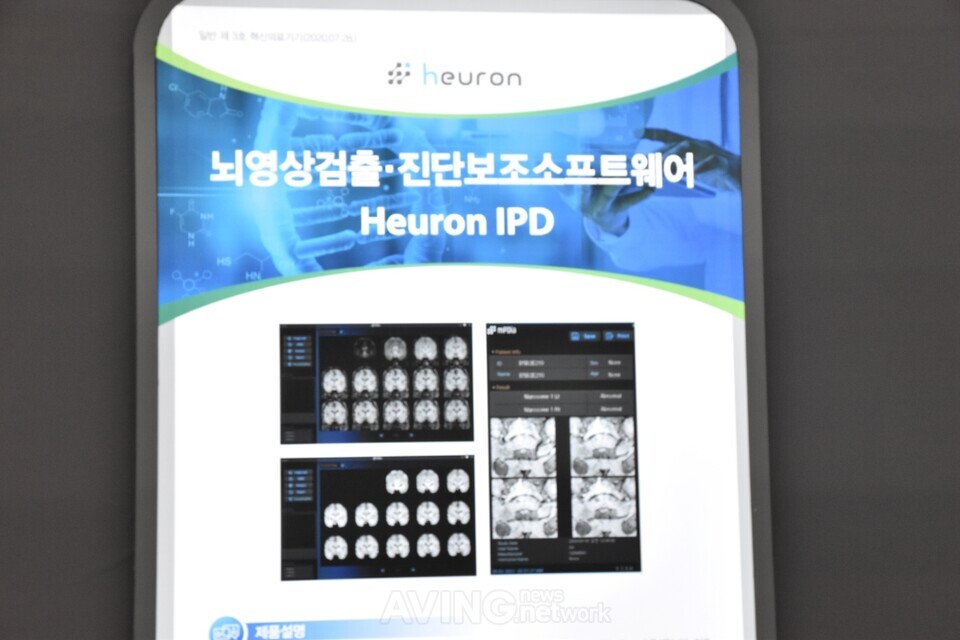 휴런, KOAMEX 2023서 뇌 영상판독 보조 시스템 소개해... “인공지능 뇌 건강검진으로 파키슨병 조기진단에 도움!”
