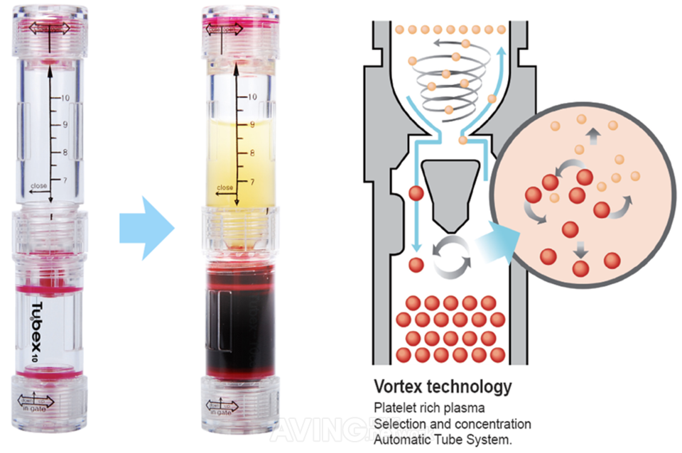무한기업, KIMES 2024서 PRP 분리 전용키트 ‘Tubex’ 선보인다... “소용돌이 공법 통해 혈소판 농축량 높여”