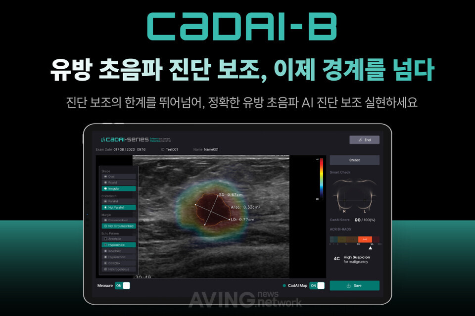 빔웍스, KIMES 2025서 유방암 진단하는 초음파 AI 솔루션 ‘CadAI-B’ 선보인다... “글로벌 경쟁력 강화에 박차”