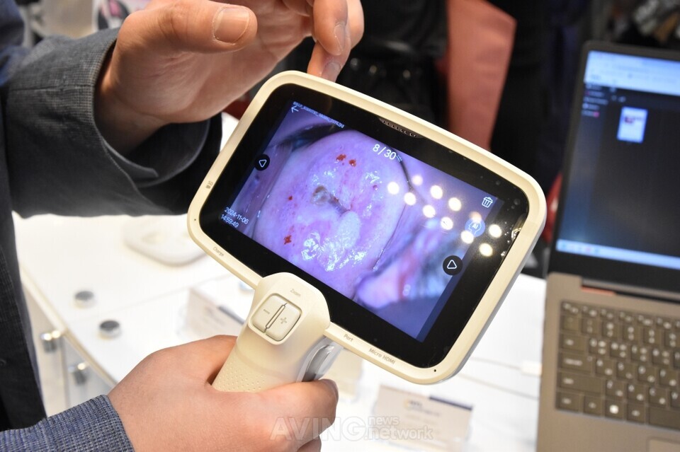 엔티엘헬스케어, KIMES 2025서 ‘CerviCARE AI’ 선보여... “700만 데이터 보유한 인공지능 자궁경부 검진 시스템!”